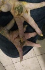 Pododermatitis (Bumblefoot): Diagnosis, Treatment, Resolution, and ...